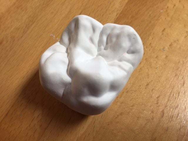 STL file Molar - Tooth 🦷・3D print design to download・Cults