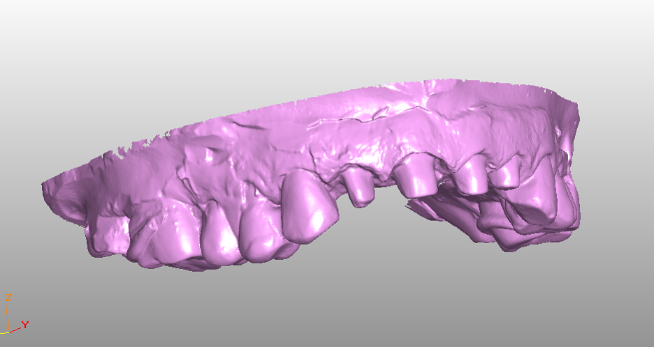 STL file Previous dental models 🔧・Design to download and 3D print・Cults