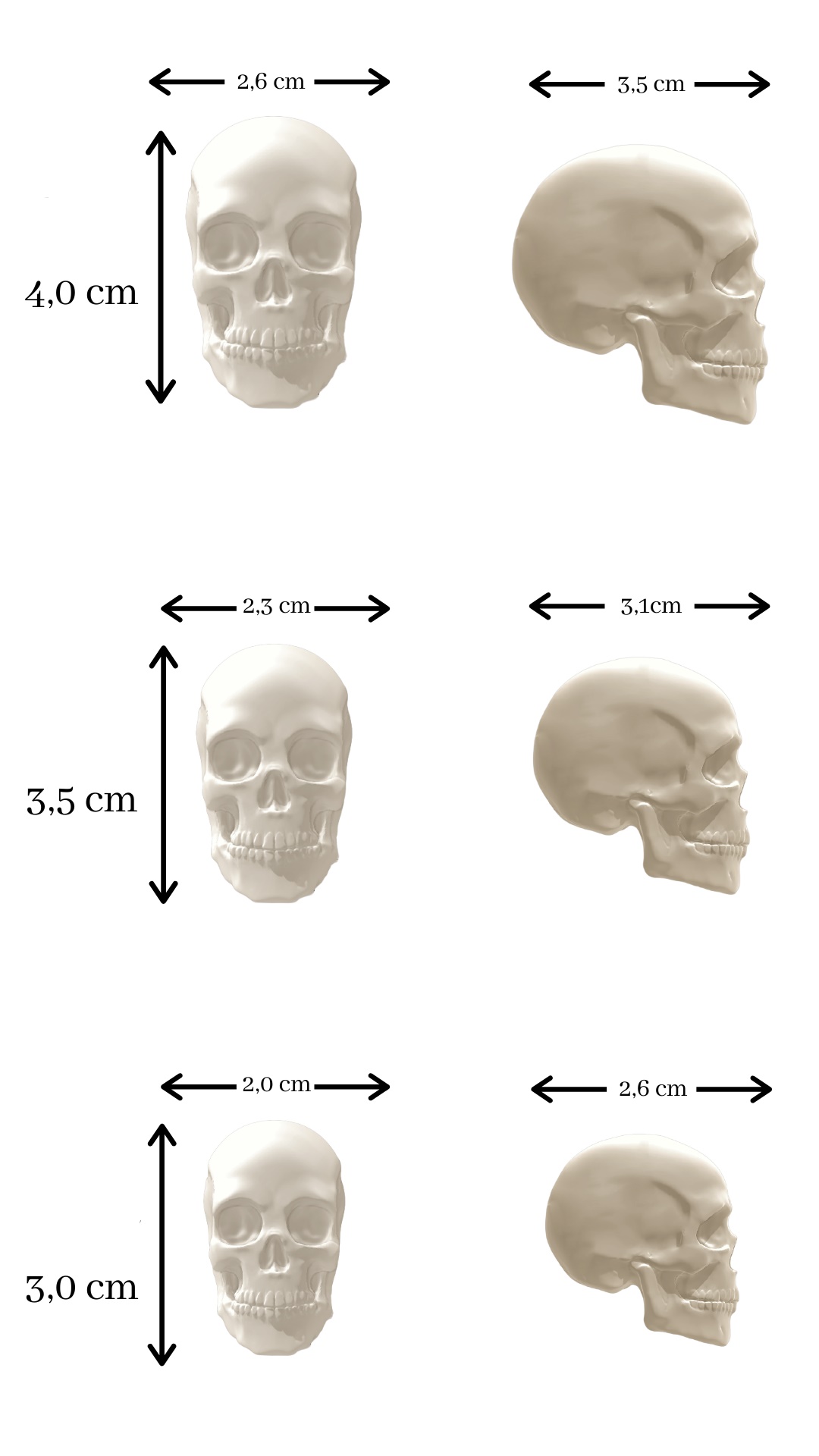 STL file Skull set 5 sizes 💀・3D print design to download・Cults