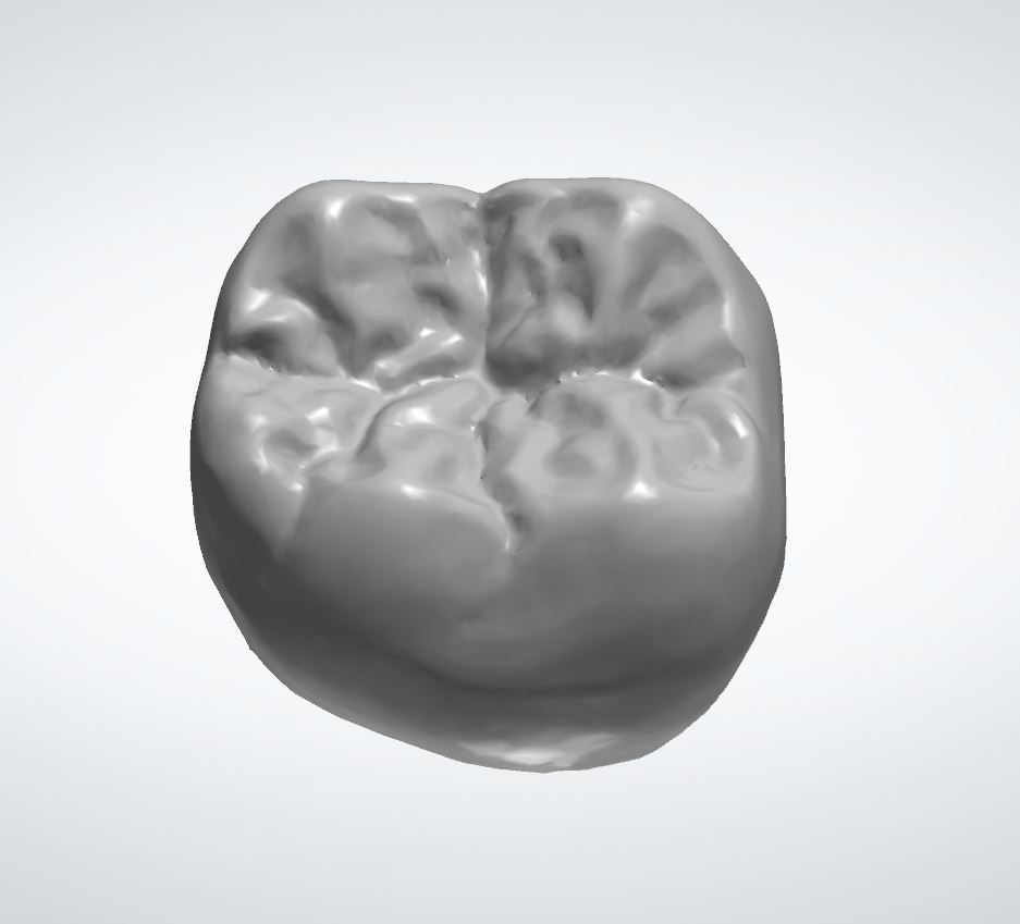 Archivo STL Morfología del diente 46・Objeto imprimible en 3D para ...