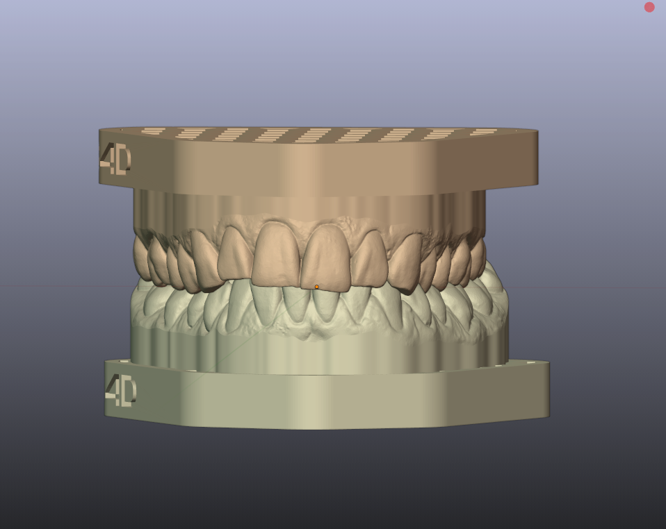 Free STL file Demonstrative models with verti articulator B4D 🦷・3D ...