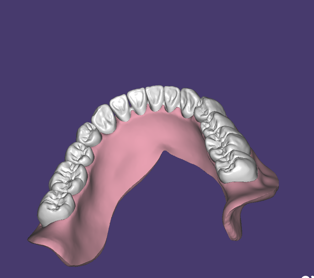 Free STL file Upper and lower full dentures. Teeth and bases 🦷・3D print ...