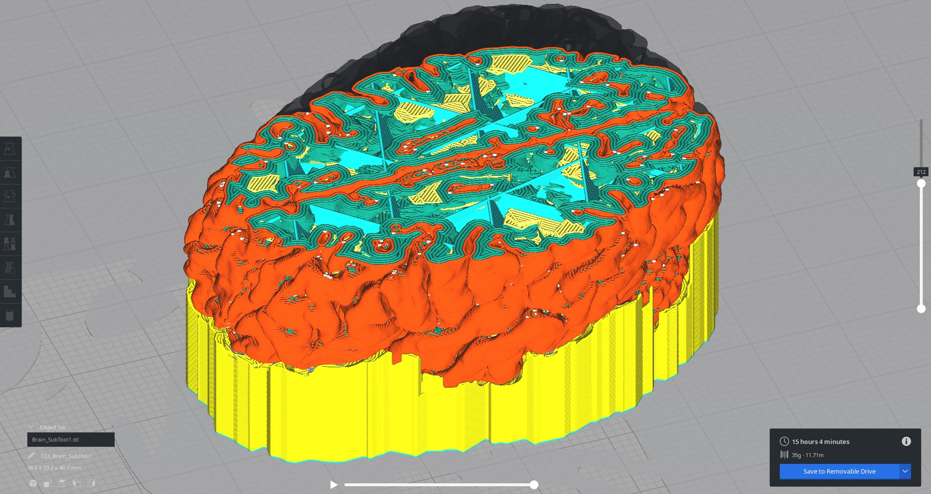 STL file MRI Scanned Human Brain model・Template to download and 3D ...