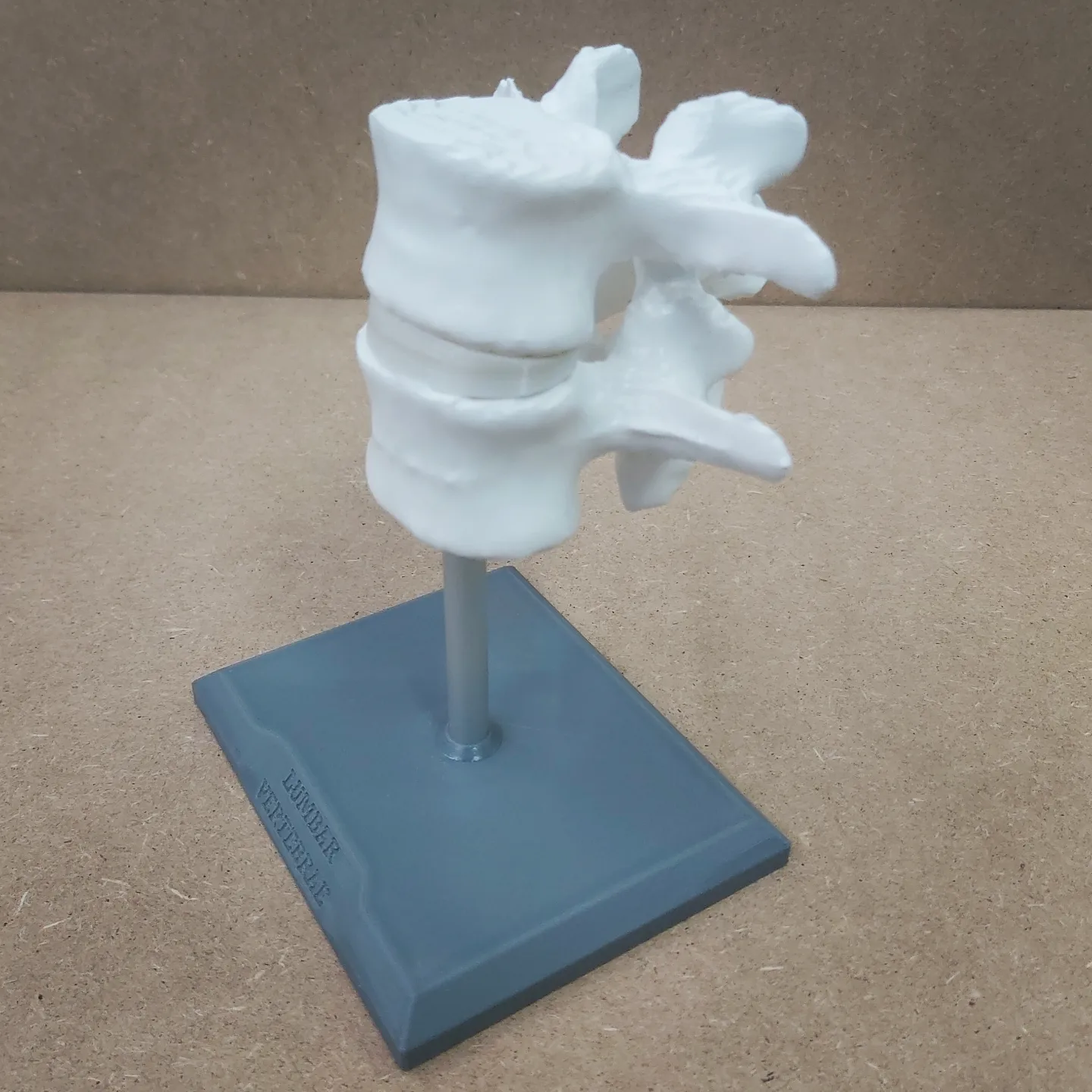 STL file Lumbar Vertebrae・3D printer model to download・Cults