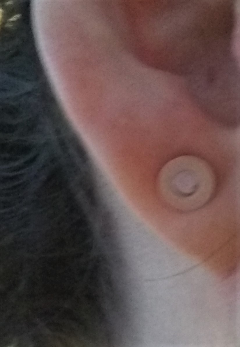 STL file Expander/ Ear Plug /Casvort・3D printable design to download・Cults