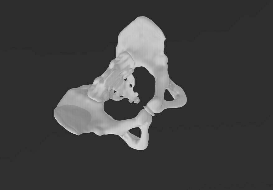 STL file female pelvis ♀️・3D printing idea to download・Cults