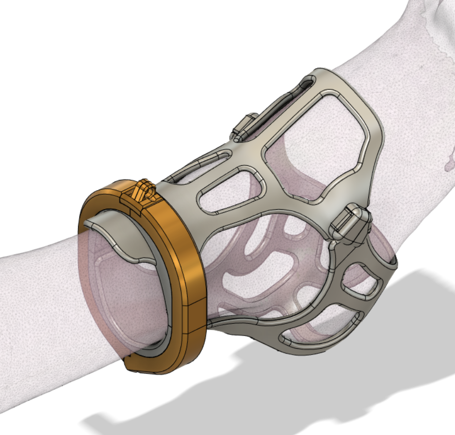 Free STL file Ankle Cage 🦶・3D printer model to download・Cults