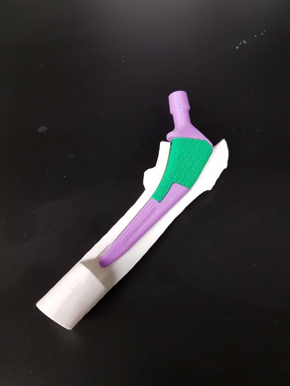 Stl File Tibia Implant Real Layout For Training ・model To Download And