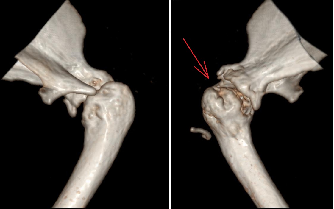 Free STL file Prosthetics of the cat's shoulder (an example of a real ...