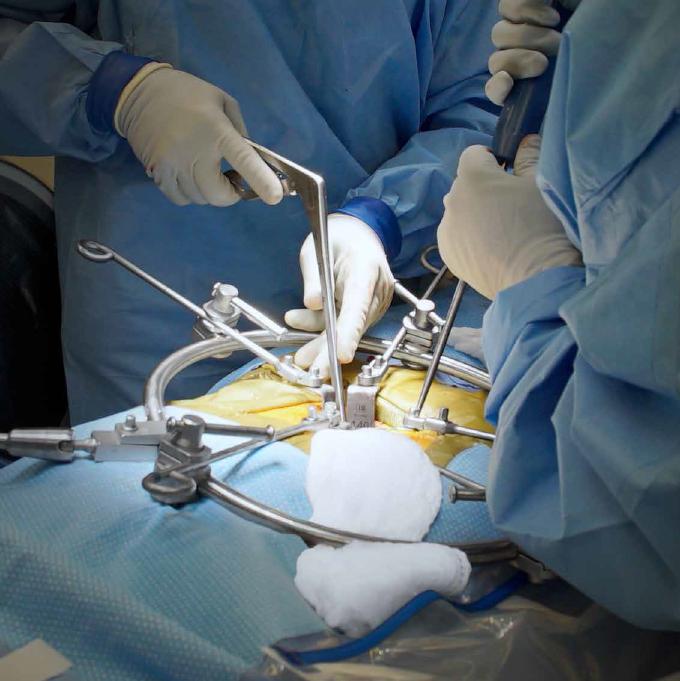 STL file Retractor blades (flat and semicircular)・3D printer model to ...