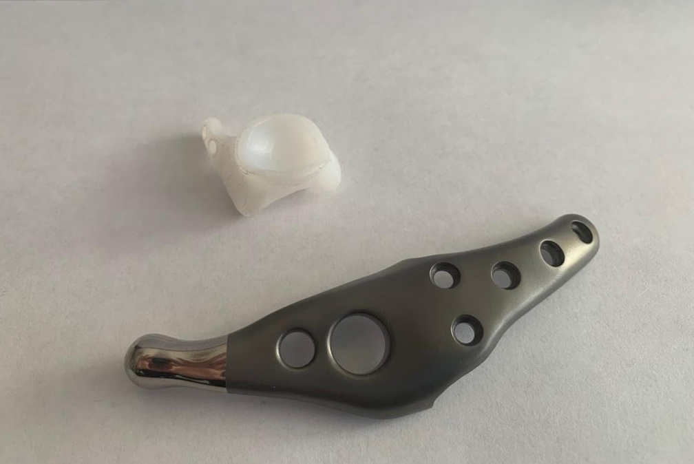 STL file Individual prosthesis for jaw reconstruction (example of a ...