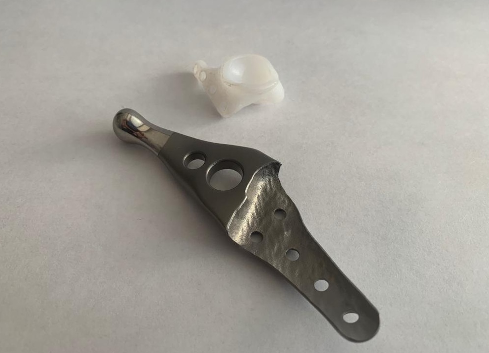 STL file Individual prosthesis for jaw reconstruction (example of a ...