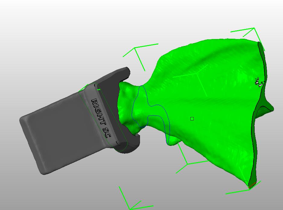 Free STL file Prosthetics of the cat's shoulder (an example of a real ...