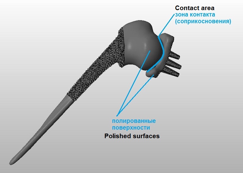 Free STL file Prosthetics of the cat's shoulder (an example of a real ...