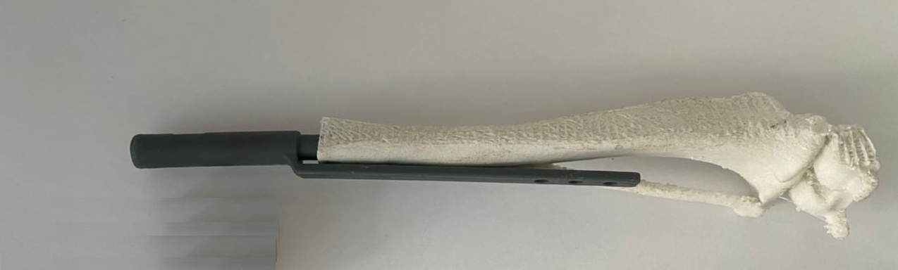 STL file ITAP implant osseointegration (real operation) 💊・Template to ...