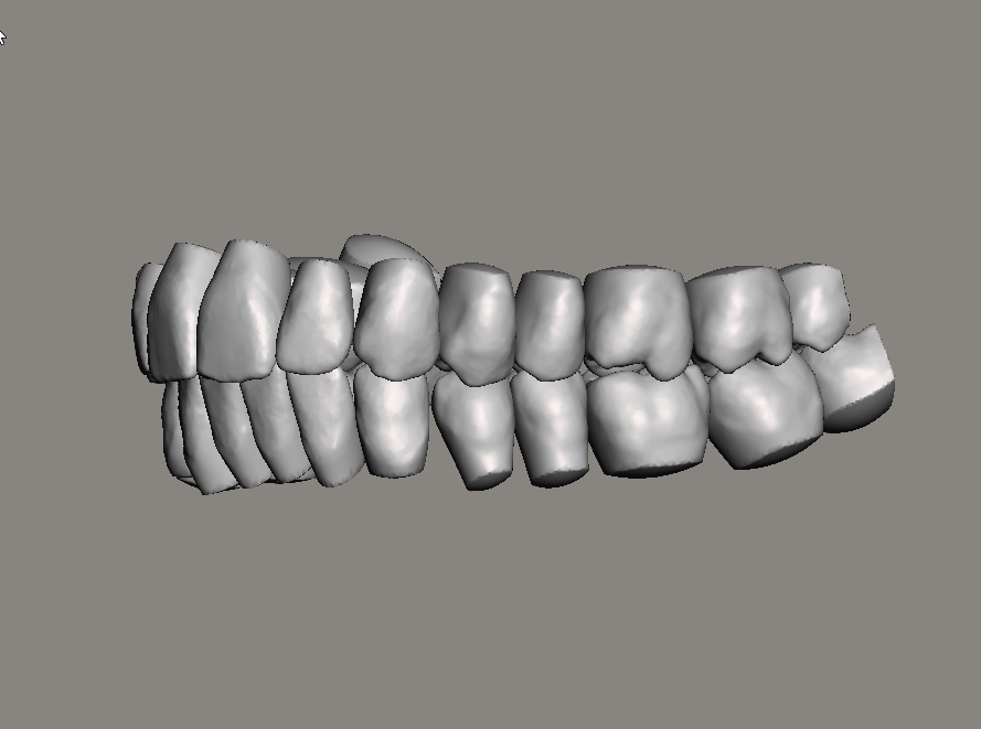 3D file Natural Tooth Library Collection (8 models) 🦷・Model to download ...