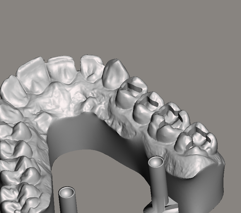 3D file Dental Models for Practice 🦷・Template to download and 3D print ...