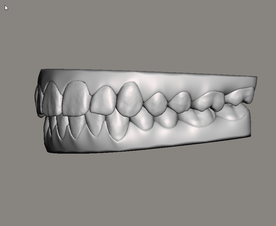 3D file Natural Tooth Library Collection (8 models) 🦷・Model to download ...