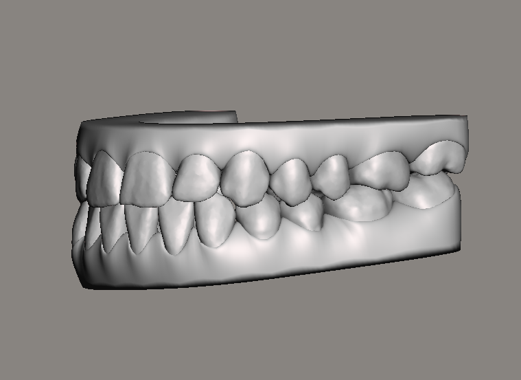 3D file Natural Tooth Library Collection (8 models) 🦷・Model to download ...