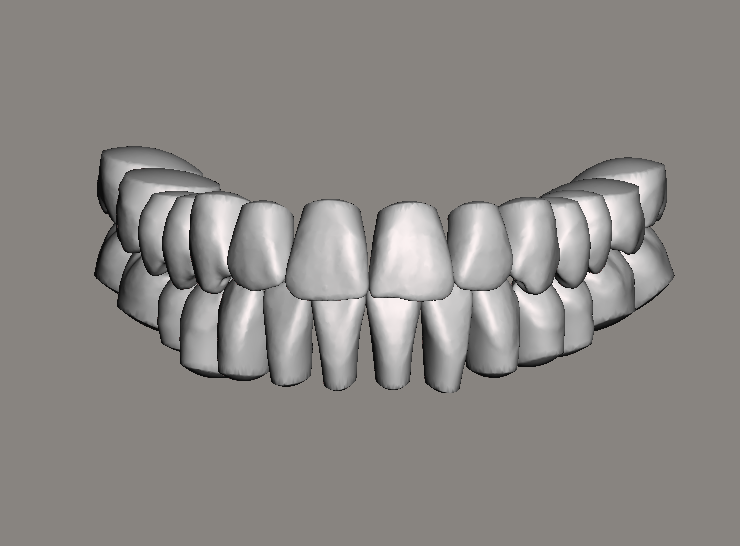 3D file Natural Tooth Library Collection (8 models) 🦷・Model to download ...