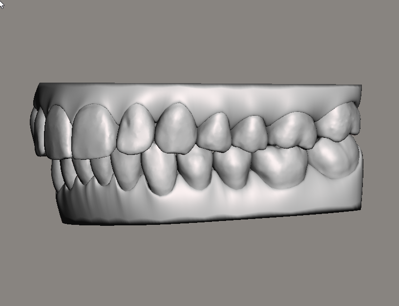 3D file Natural Tooth Library Collection (8 models) 🦷・Model to download ...