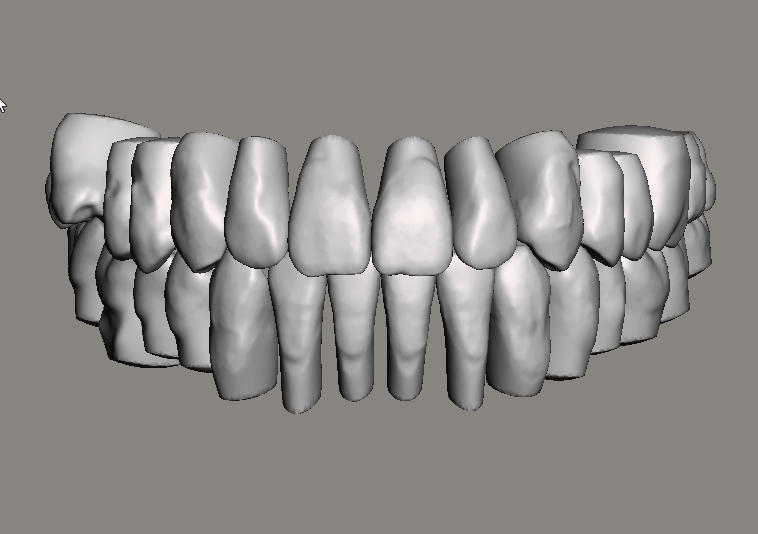 3D file Tooth Library STL Collection (8 models)・3D printer model to ...