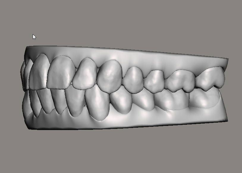 3D file Natural Tooth Library Collection (8 models) 🦷・Model to download ...