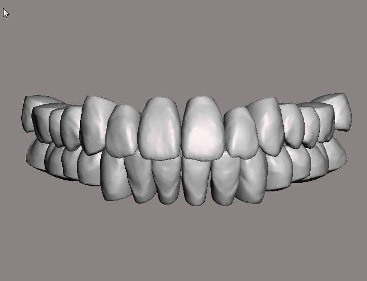 3D file Natural Tooth Library Collection (8 models) 🦷・Model to download ...