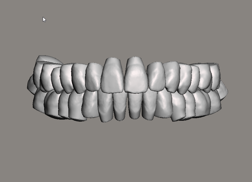 3D file Natural Tooth Library Collection (8 models) 🦷・Model to download ...