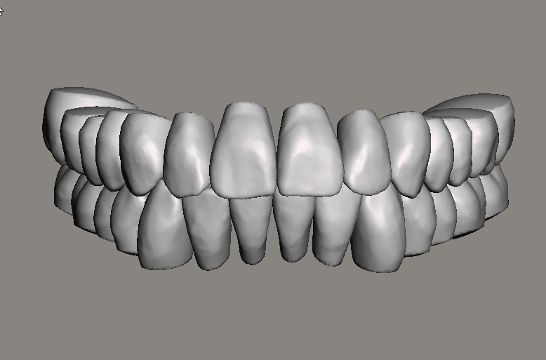 3D file Natural Tooth Library Collection (8 models) 🦷・Model to download ...