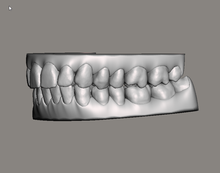 3D file Natural Tooth Library Collection (8 models) 🦷・Model to download ...