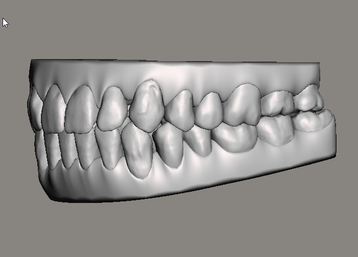 3D file Natural Tooth Library Collection (8 models) 🦷・Model to download ...