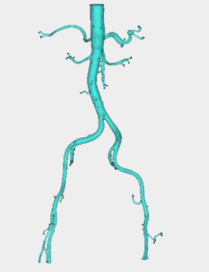 STL file arteries・3D printer model to download・Cults
