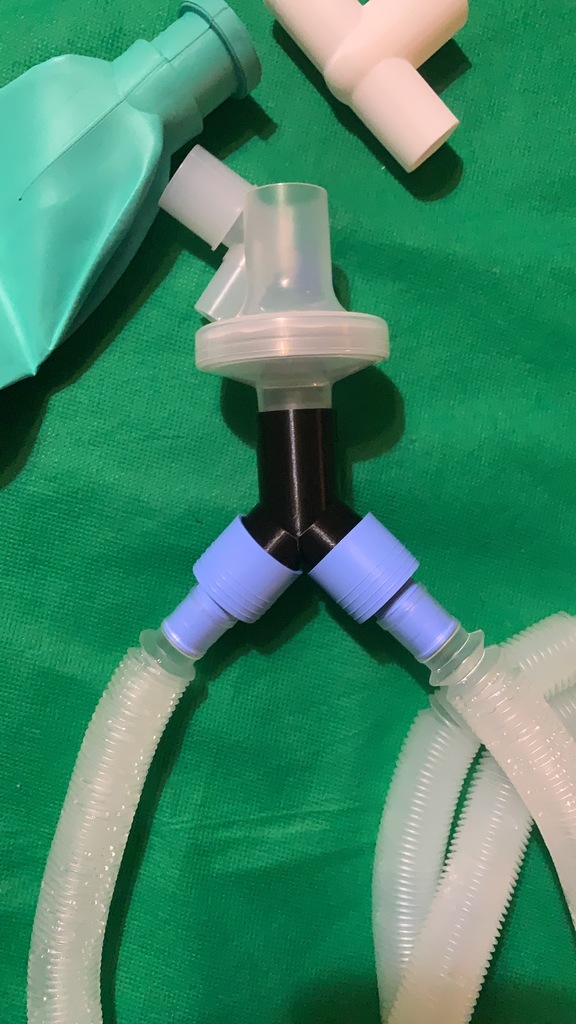 Free 3D file Y adaptor for 2 patients in 1 ventilator・3D printing idea ...