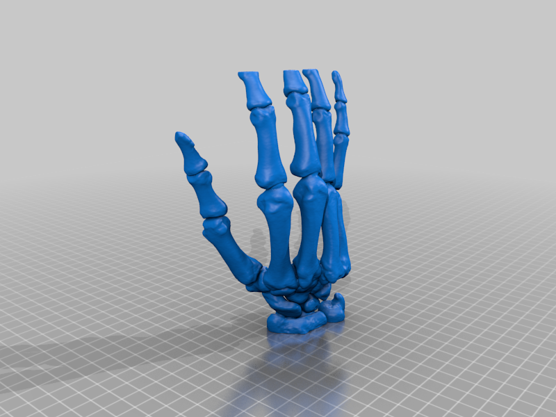 Free 3D file Hand bone. Dislocation 4 and 5 metacarpal joint ・3D ...