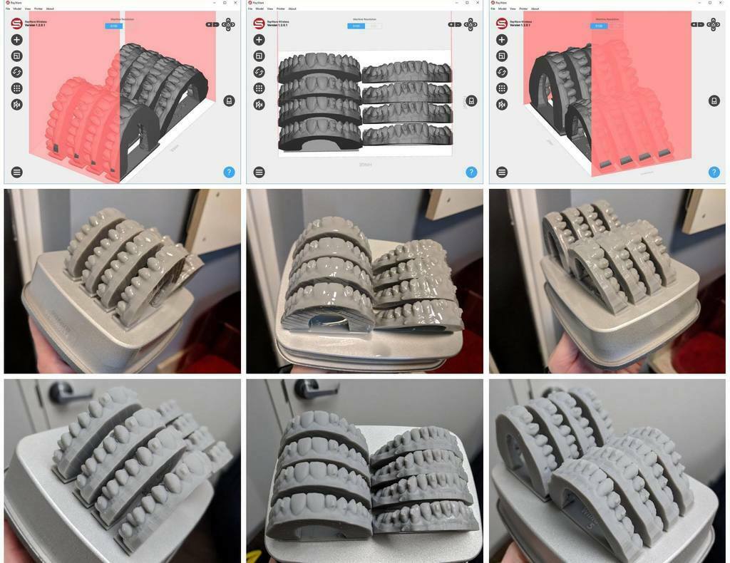 Free 3D file Ortho Models - Combine Platforms - 1,2,3,4,6,8・3D printer ...