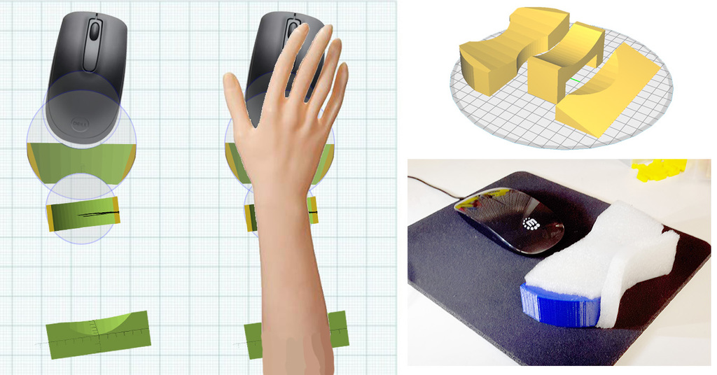Free 3D file Customizable Wrist Support・Object to download and to 3D ...