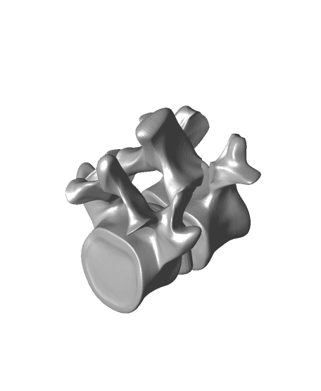 Free 3D file Spondy grade 1 bennett models.stl・3D printable object to ...