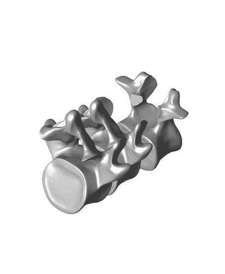 Free 3D file 3 VB version with a grade 1 Spondy models.stl・3D printing ...