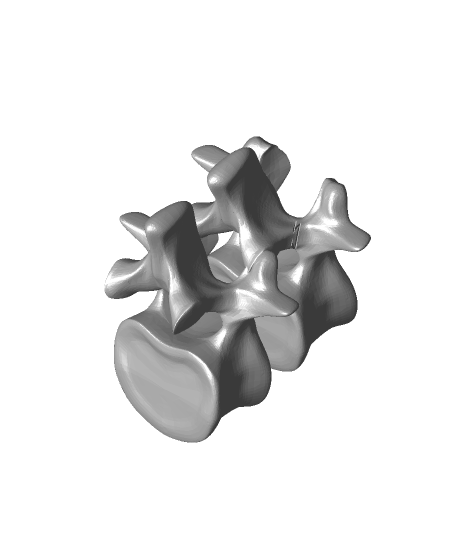 Free 3D file Spondylolysis with 2 VBs models.stl 👽・3D printing design ...
