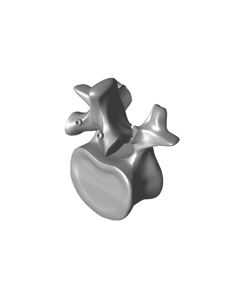 Free 3D file Spondy single level pars repair demo model.stl・Model to ...