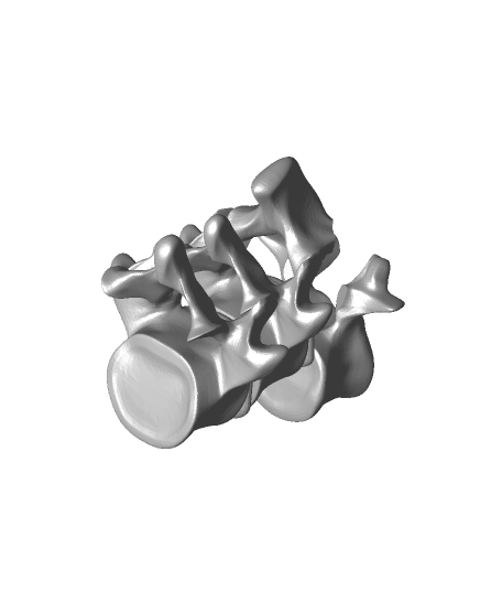 Free 3D file 3 VB version of high grade Spondy models.stl・3D printer ...