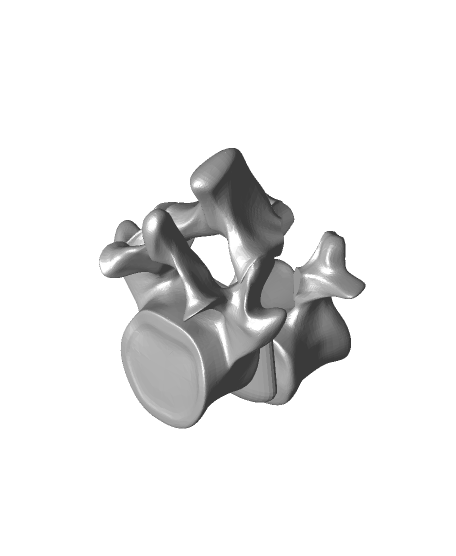 Free 3D file Spondy grade 2 listhesis bennett model.stl・3D printing ...