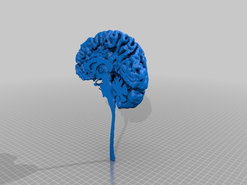 Free 3D file My brain; scanned from an MRI・3D printer design to ...