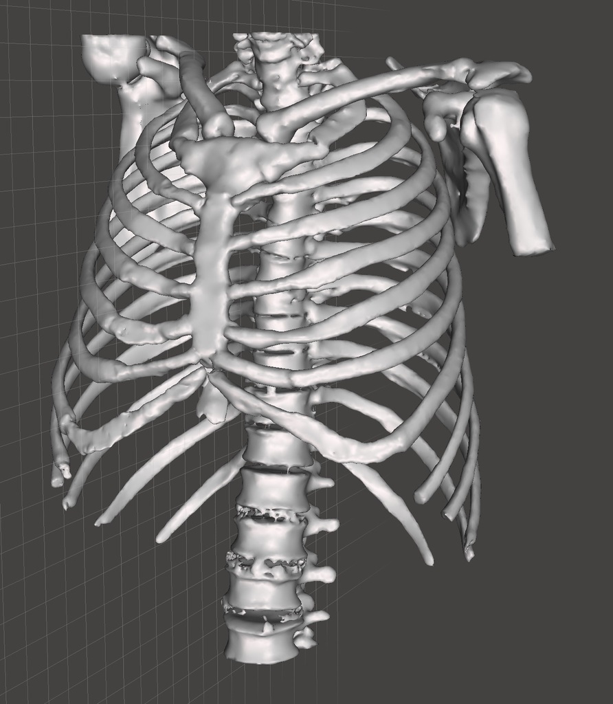 Archivo 3D gratis Tórax humano reparado・Modelo para descargar y imprimir en 3D・Cults