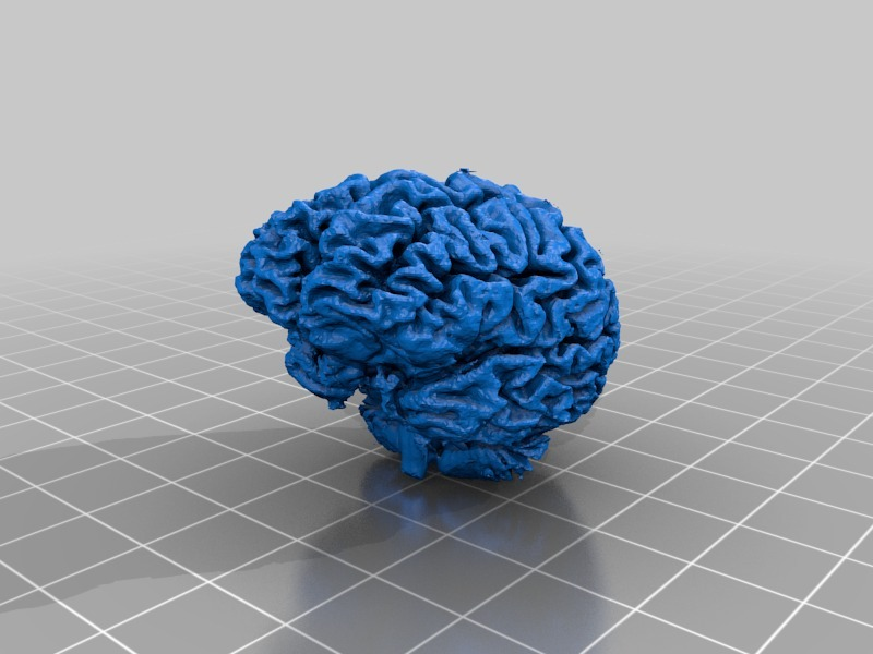 Free 3D file Skull with brain・Model to download and 3D print・Cults