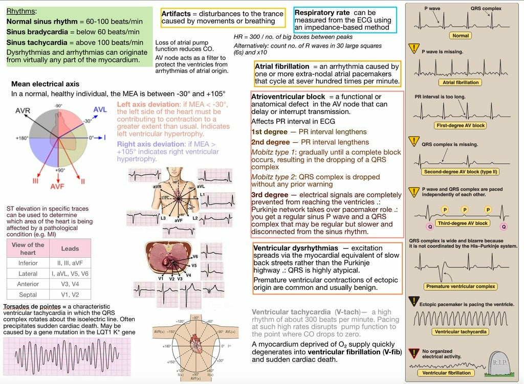Archivo STL gratis Visualizador 3D de ECG 🎒・Modelo de impresión 3D para ...